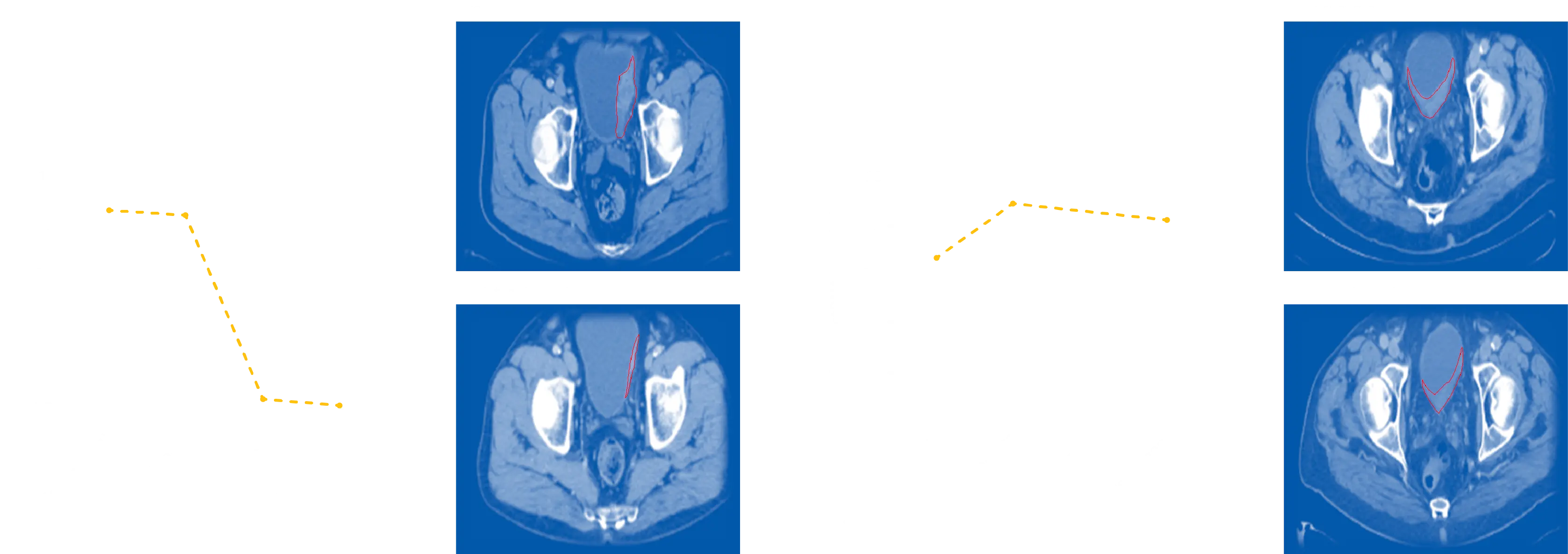 RaDaR ST for Pharma Partners | NeoGenomics Laboratories